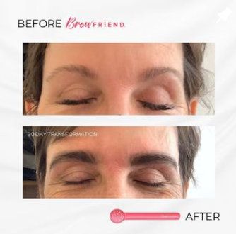 BrowFriend | The Original Red Light Therapy For Brows